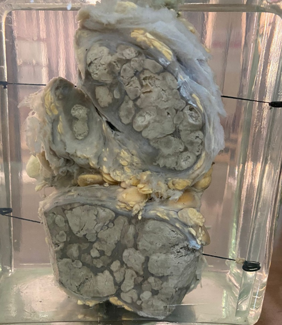 The Pathology Museum